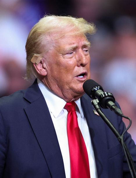 Trumpin korvaa hoitanut lääkäri: Kahden sentin haava ei vaatinut ...