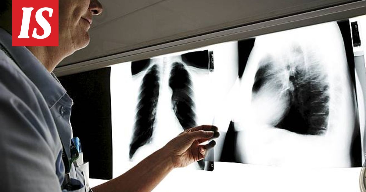 SS: Raju paljastus savolaisesta sairaalasta - Ilta-Sanomat