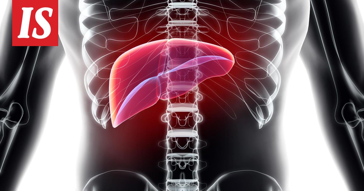 Merkit huomaa usein vasta, kun maksa on jo vaurioitunut: 8 asiaa, jotka ...