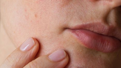 Iho kuivui syksyn myötä: nämä kasvovoiteet ja niiden aineosat auttavat ...