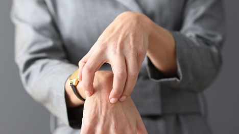 Syyhy on yleistynyt hurjasti – näin se tarttuu, tunnista oireet - Ilta ...