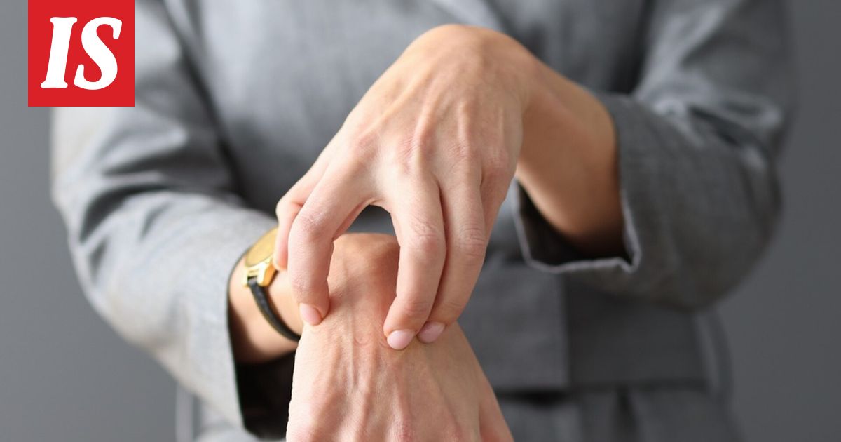 Syyhy on yleistynyt hurjasti – näin se tarttuu, tunnista oireet - Ilta-Sanomat