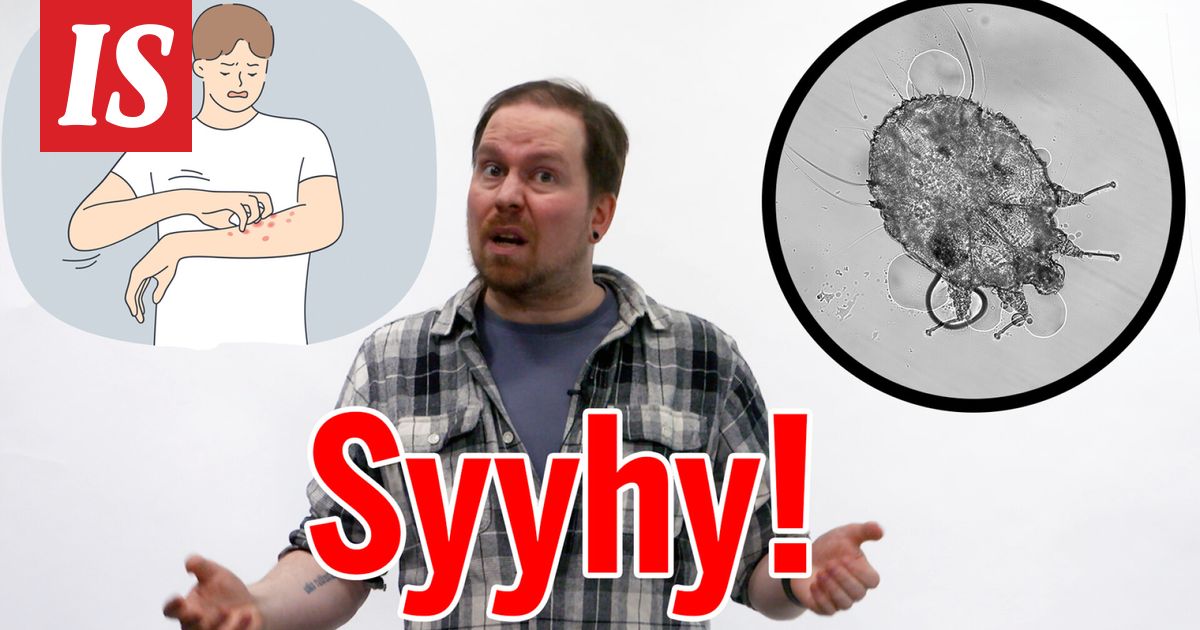 Millainen on vauhdikkaasti leviävä syyhy? Video tiivistää oleellisimmat ...
