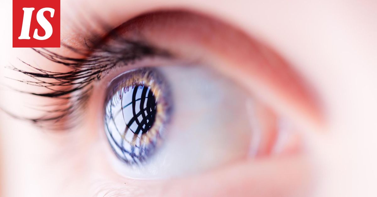 Mitä silmät kertovat terveydestäsi? 11 silmäoiretta, jotka voivat ...