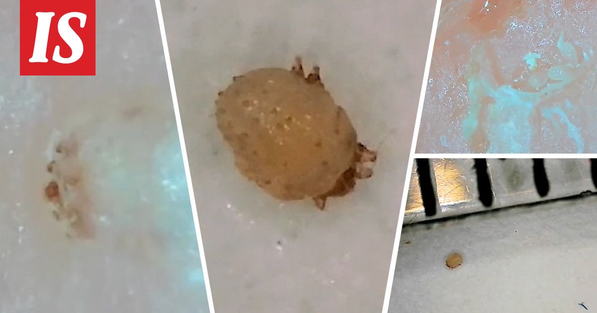 Syyhypunkki piinasi Miikan perhettä kuukausia - Ilta-Sanomat