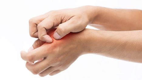 Lintukirppu puree syksyllä ja keväällä - Ilta-Sanomat