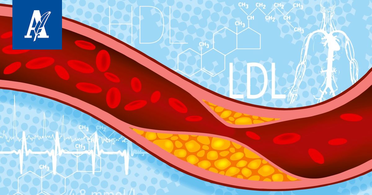 Kohonneet kolesteroliarvot ovat kaikenikäisten ongelma – Sydänlääkärit ...