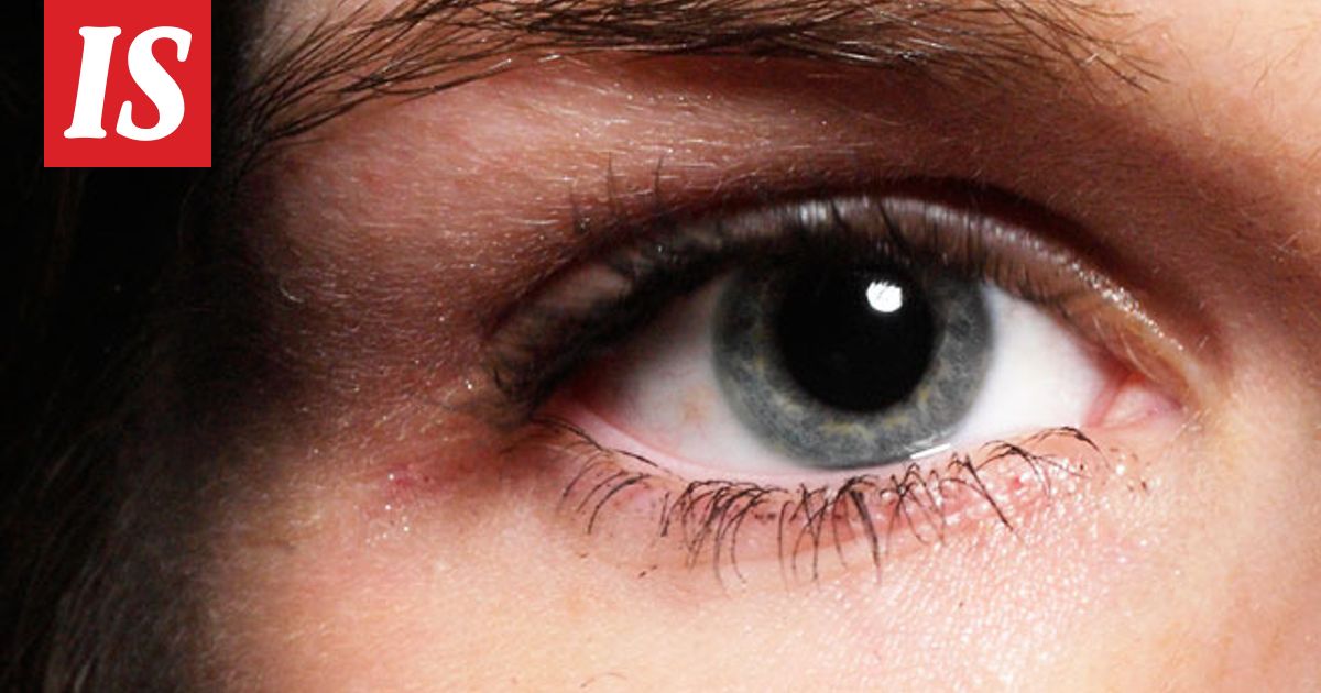 HS: Parantamaton tauti uhkaa tuhansien suomalaisten näköä - Ilta-Sanomat