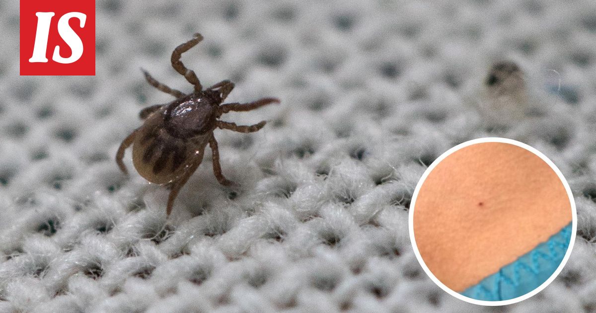 Yksi kuva kertoo, kuinka huomaamattomalta punkki voi näyttää iholla ...