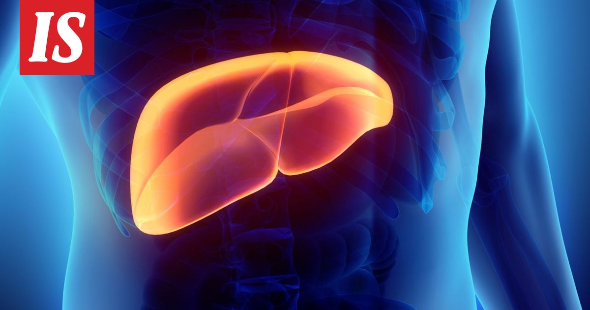 Kohonneet maksa-arvot ovat yhä useamman suomalaisen vaiva - Ilta-Sanomat