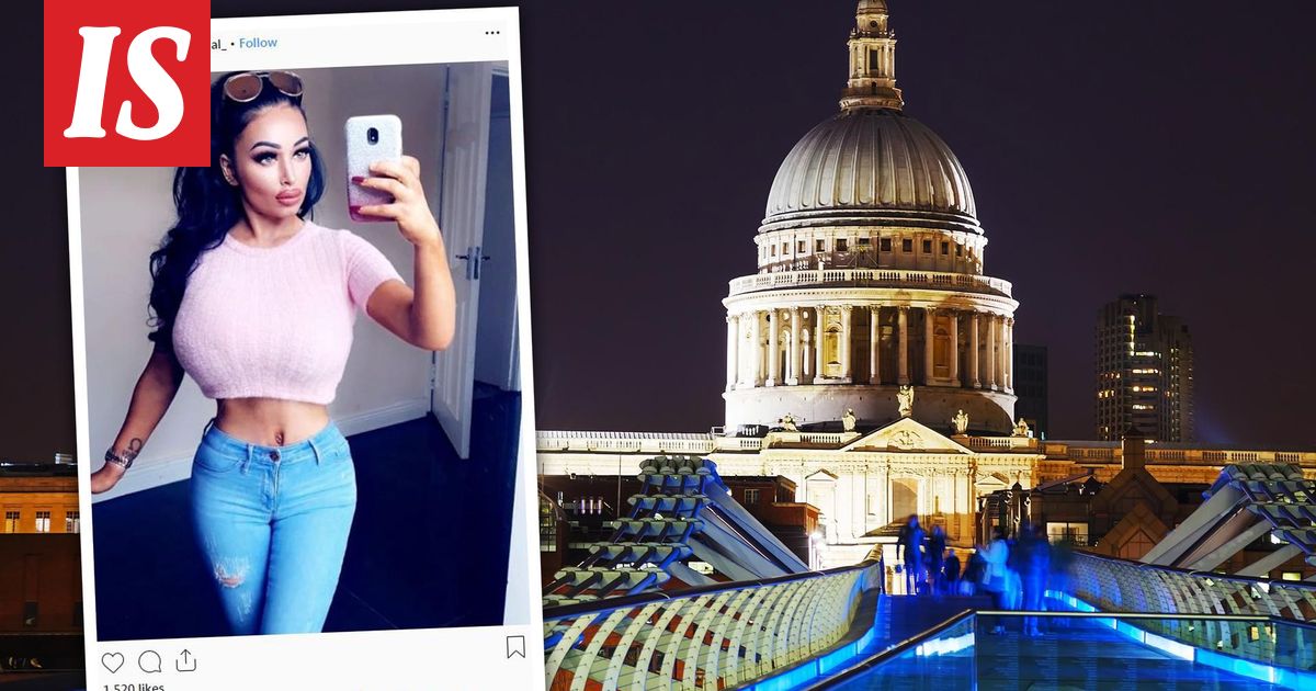 Perheenäidin rinnat ovat niin suuret, että iho repeilee – havittelee ...