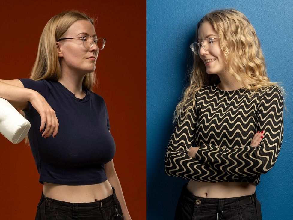 Elli ”Megalollo” Kiisken 75G-koon rinnat leikattiin – kuvat ennen ja ...