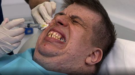 Tohtori Paise, Paiseklinikka, Paisetohtorit ja Tohtori jalkapaise ...