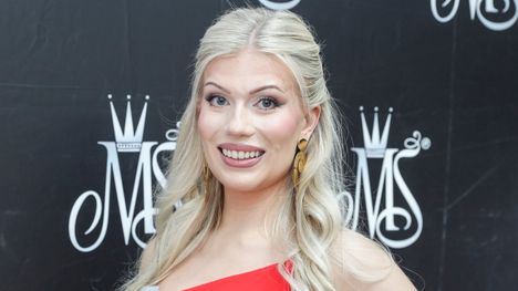 Meri Turusella on harvinainen vaiva silmässään - Ilta-Sanomat