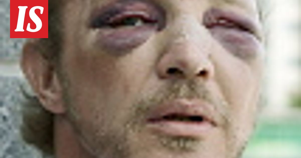 Simo Rantalainen: Minut yritettiin murhata - Ilta-Sanomat