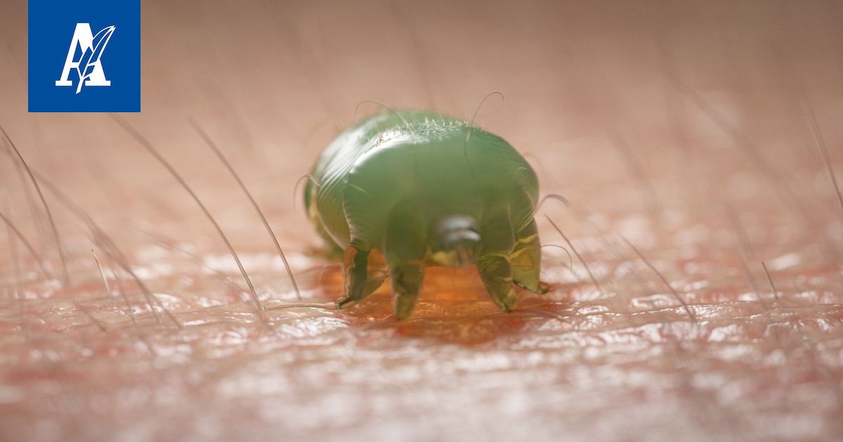 Syyhypunkki on levinnyt tänä vuonna ennätysvauhtia: Taysin lääkäri ...