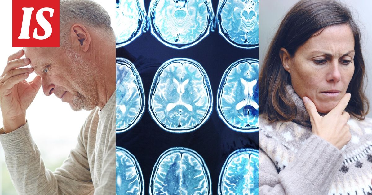 Lewyn kappale -tauti on luultua yleisempi - Ilta-Sanomat