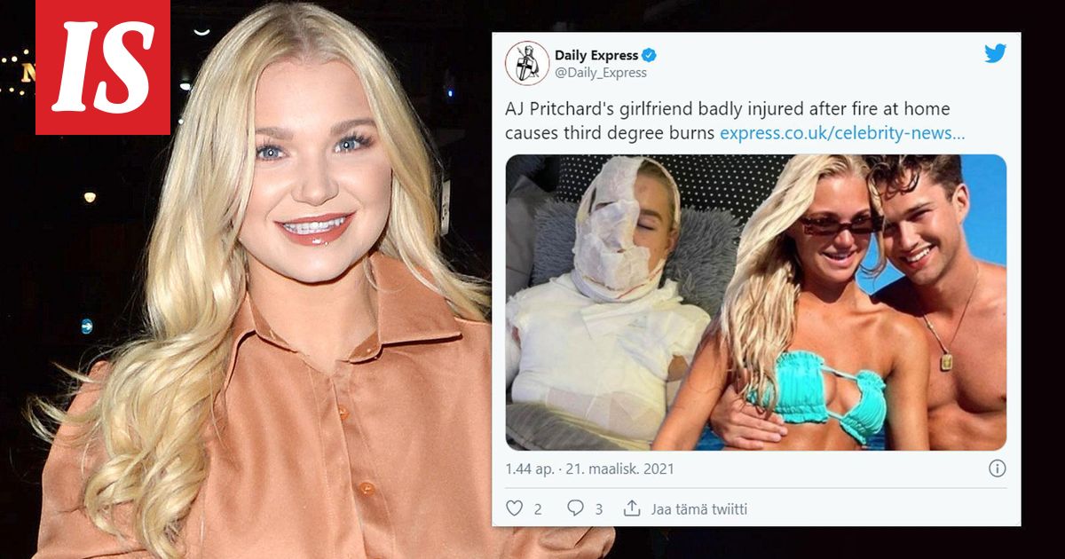 Somehaaste meni pieleen kammottavalla tavalla – 23-vuotias nainen leimahti ilmiliekkeihin ...