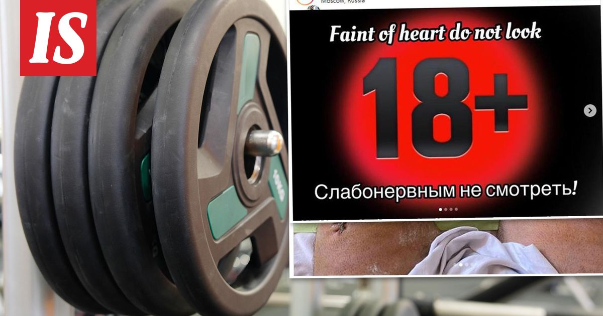 Aleksandr Sedyh julkaisi leikkauksen jälkeiset kuvat 400 kilon ...